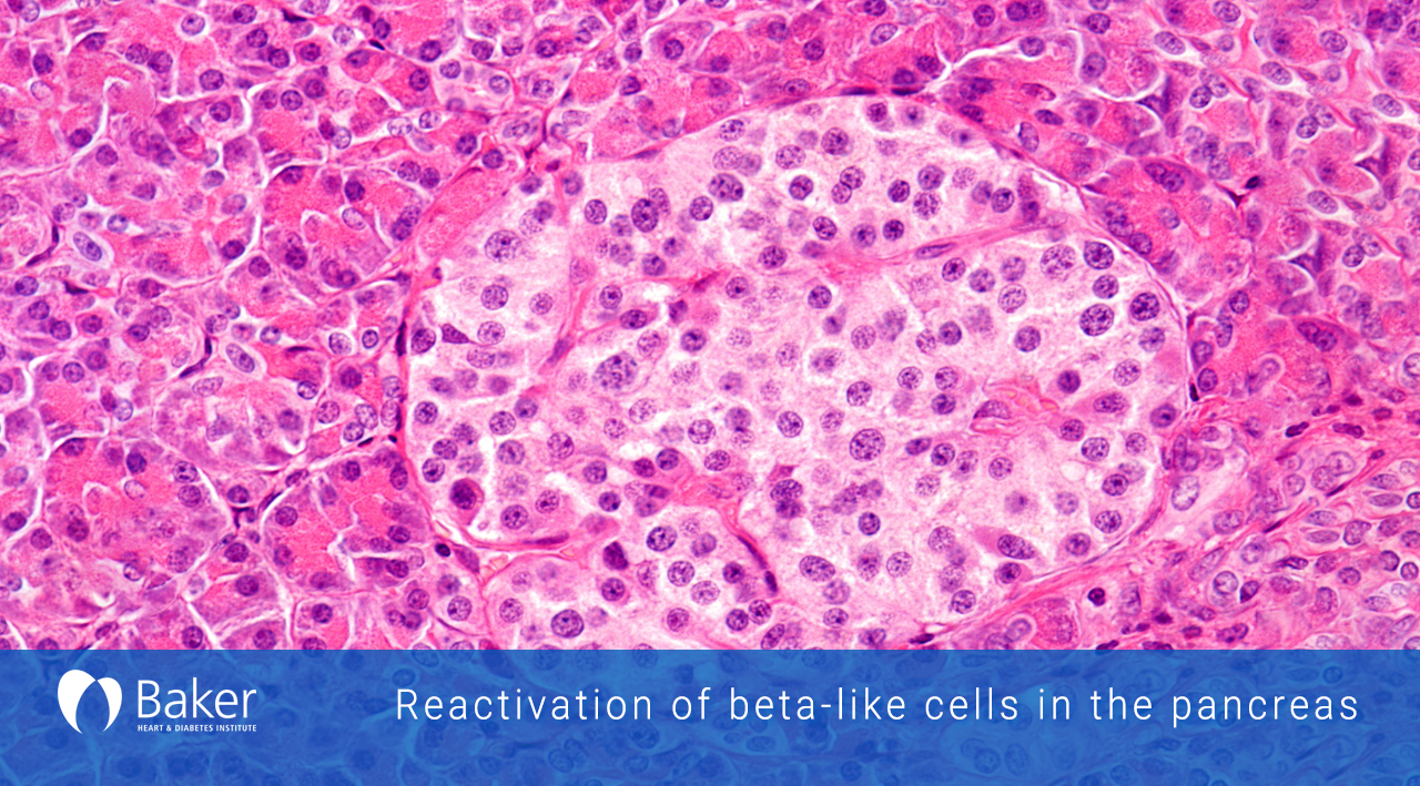 Reactivation of Beta-Like Cells in Pancreas Produces Insulin: Study ...