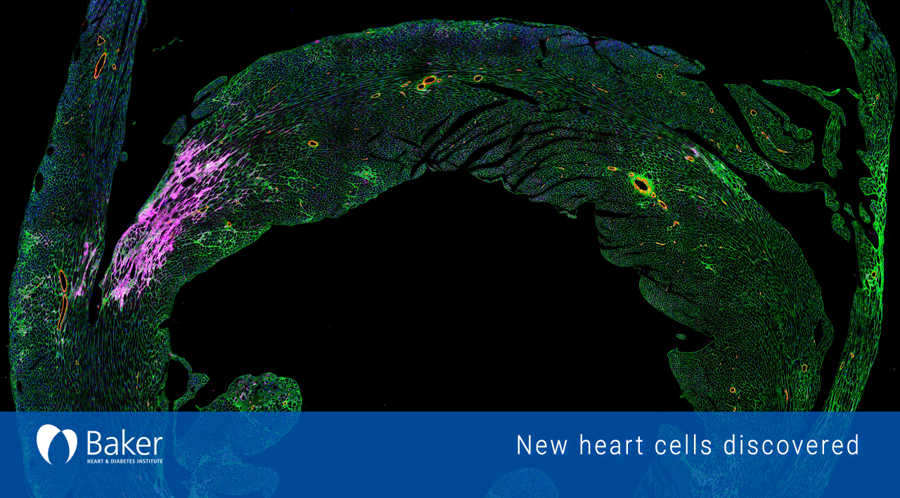 New heart cells discovered