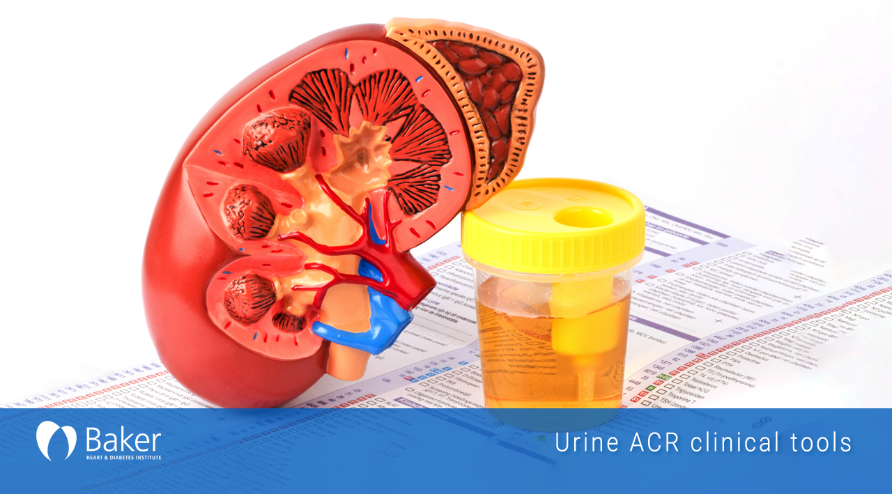 Urine ACR clinical tools | Baker Heart and Diabetes Institute